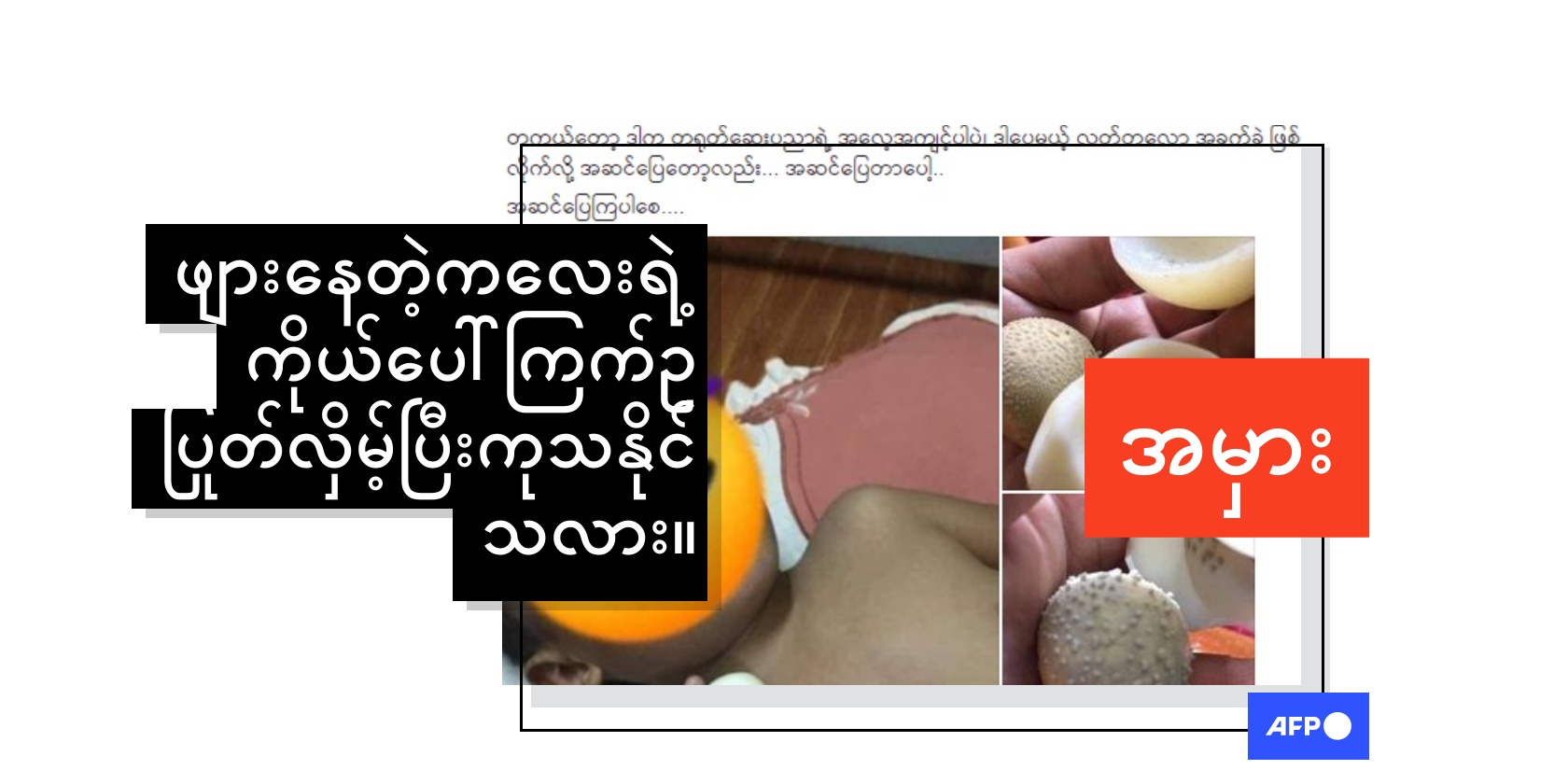 ဖျားနေတဲ့ကလေးရဲ့ကိုယ်ပေါ် ကြက်ဥပြုတ်လှိမ့်ပေးရင် အဖျားပျောက်တယ်ဆိုတဲ့ နားလည်မှုလွဲစေတဲ့ပို့စ်တွေ